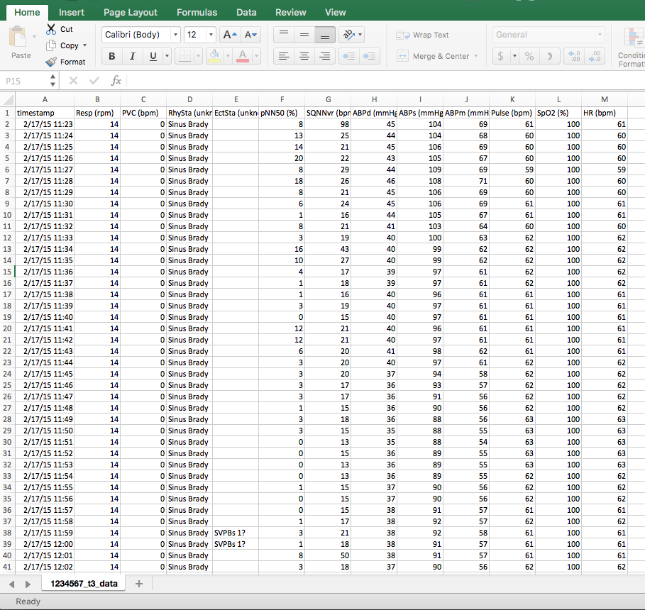 Solved Summary Of Multiple Csv Files Jmp User Community